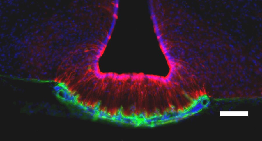 Artikel: CBBM | Center of Brain, Behavior and Metabolism